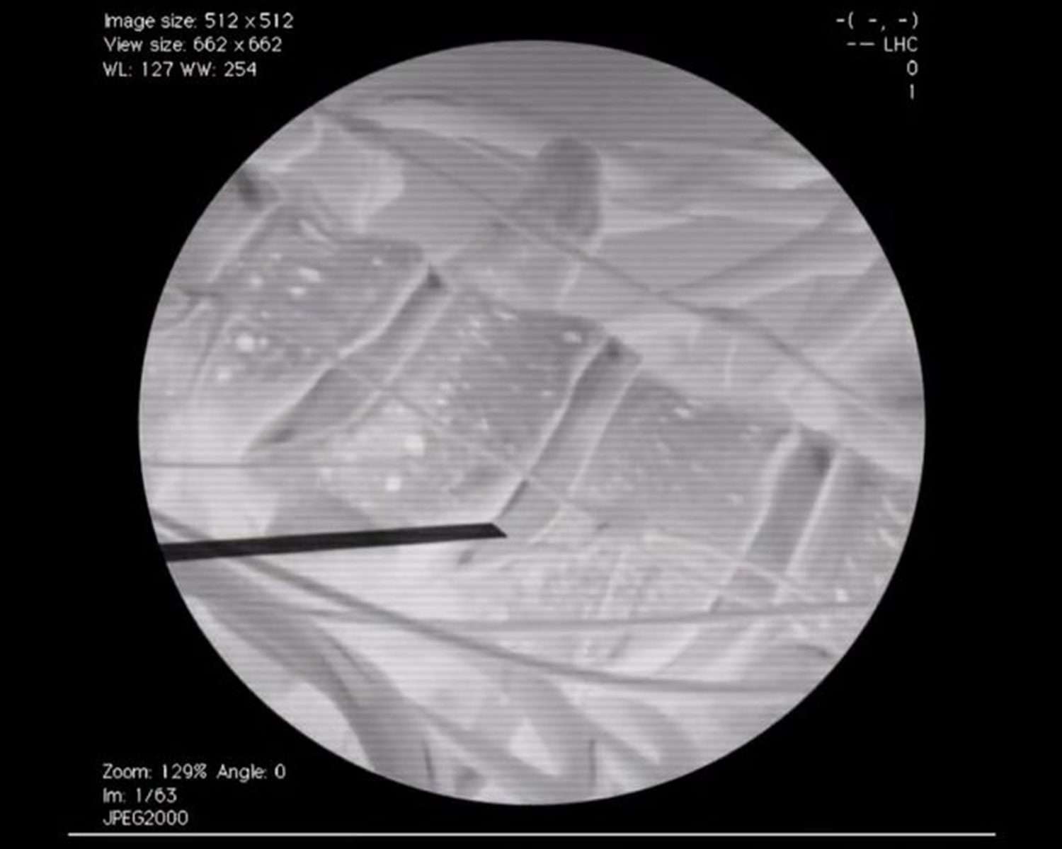 Nerve Block Image Gallery | Pain Treatments