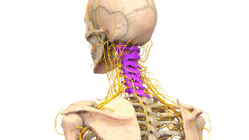 Cervical Medial Branch RFA for Neck & Headache Pain